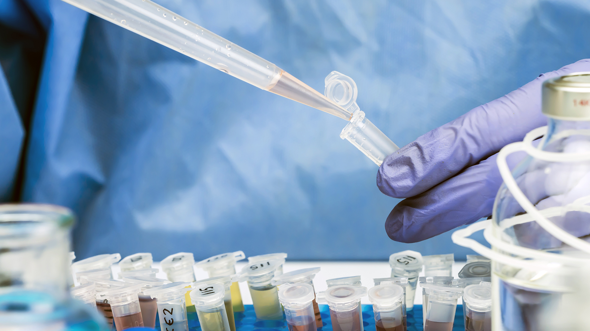 How Many Immunoassay Test Types Can Your Lab Handle? | Block Scientific