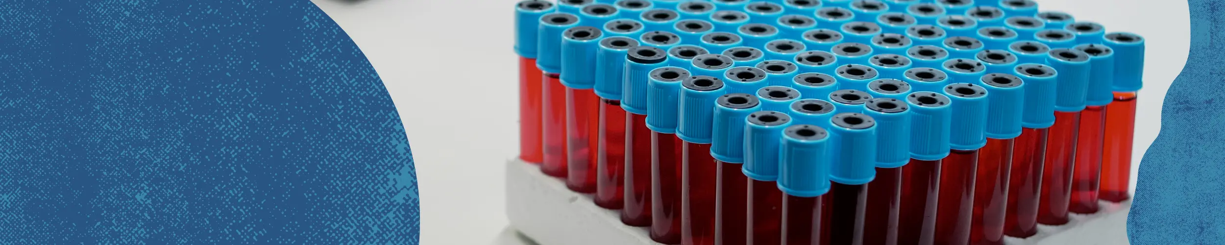 A Refurbished Olympus AU400 Chemistry Analyzer | Block Scientific