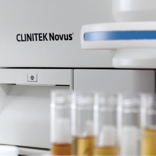 CLINITEK Novus® Automated Urine Chemistry Analyzer | Block Scientific
